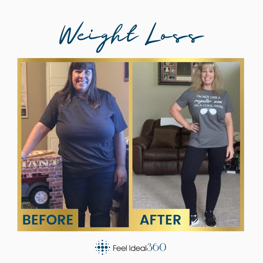 Weight Loss Before And After Southlake Texas Feel Ideal 360 Med Spa